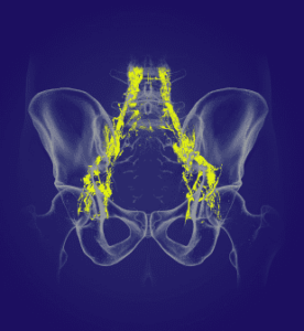 About Lipiodol – Guerbet Lipiodol